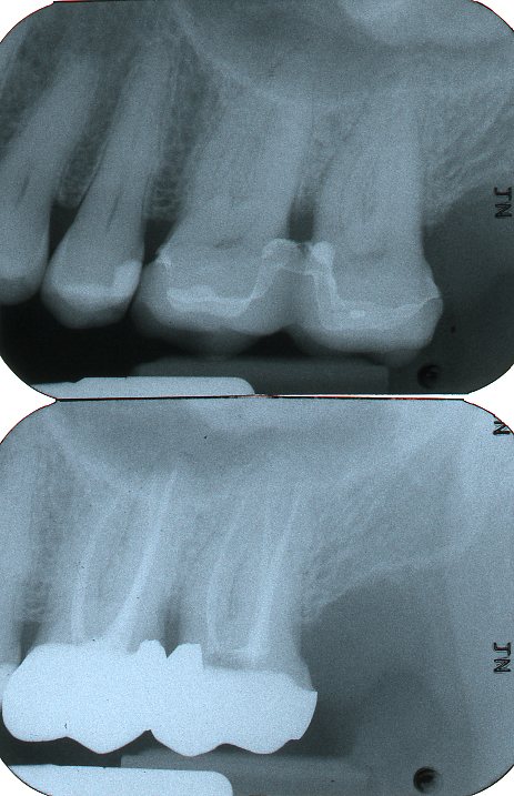Procedures – Dr. Paul Showers DDS MS PC